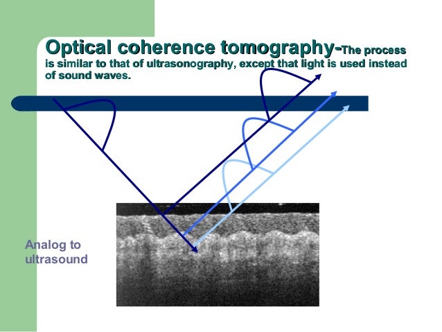 Optical coherence tomography information phase - nerygems