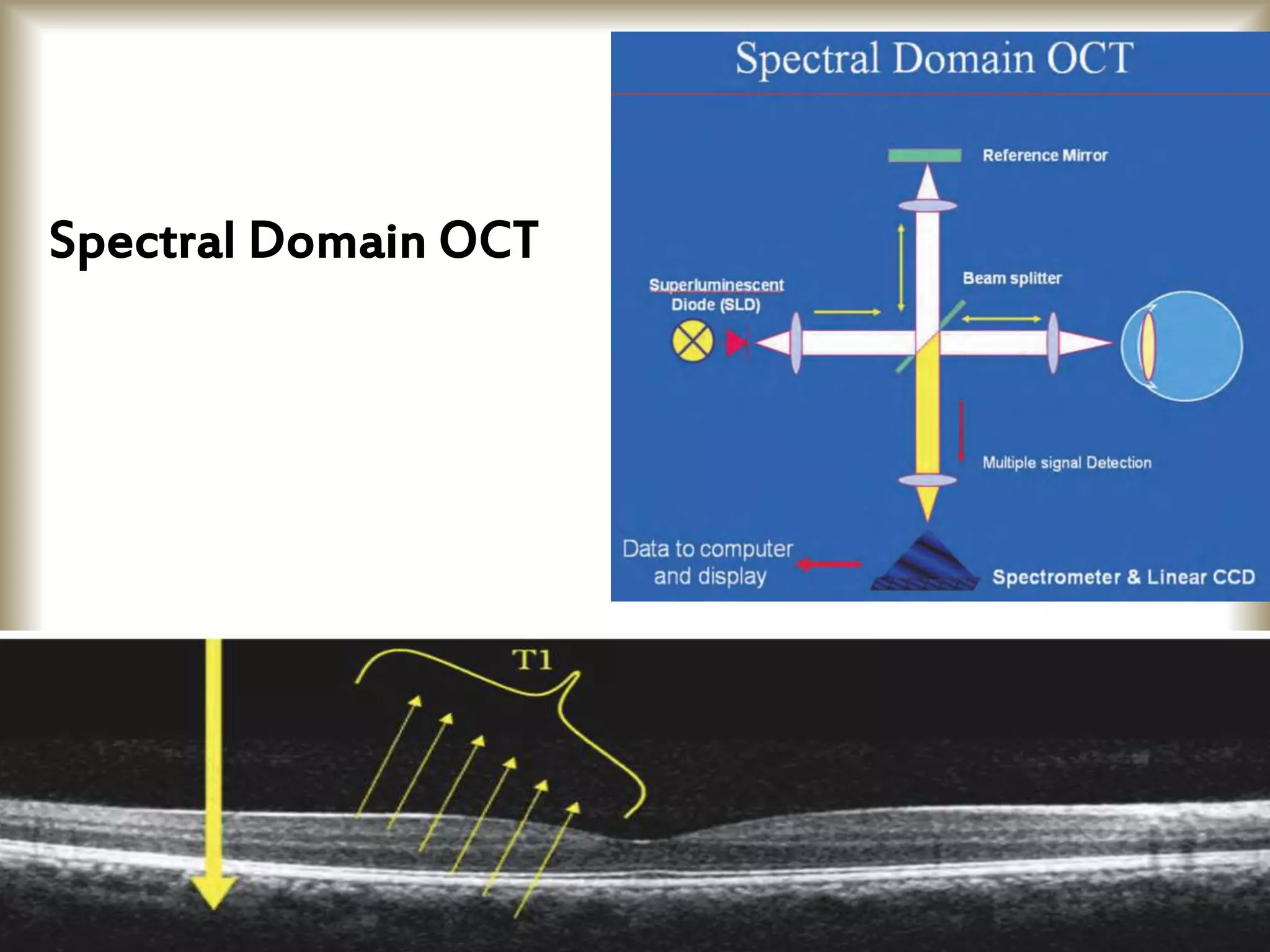 Optical Coherence Tomography | PPTX