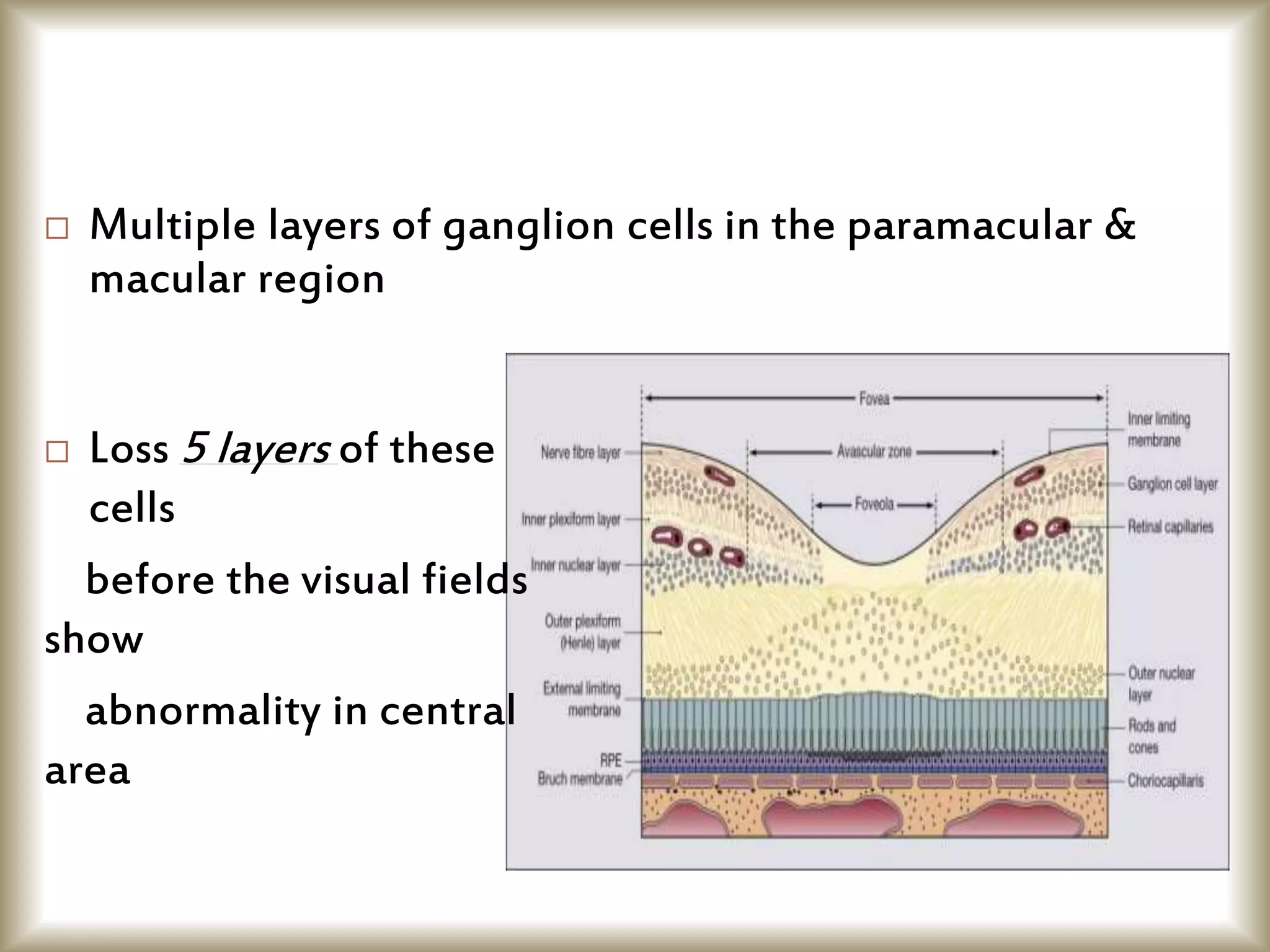 Optical Coherence Tomography | PPTX