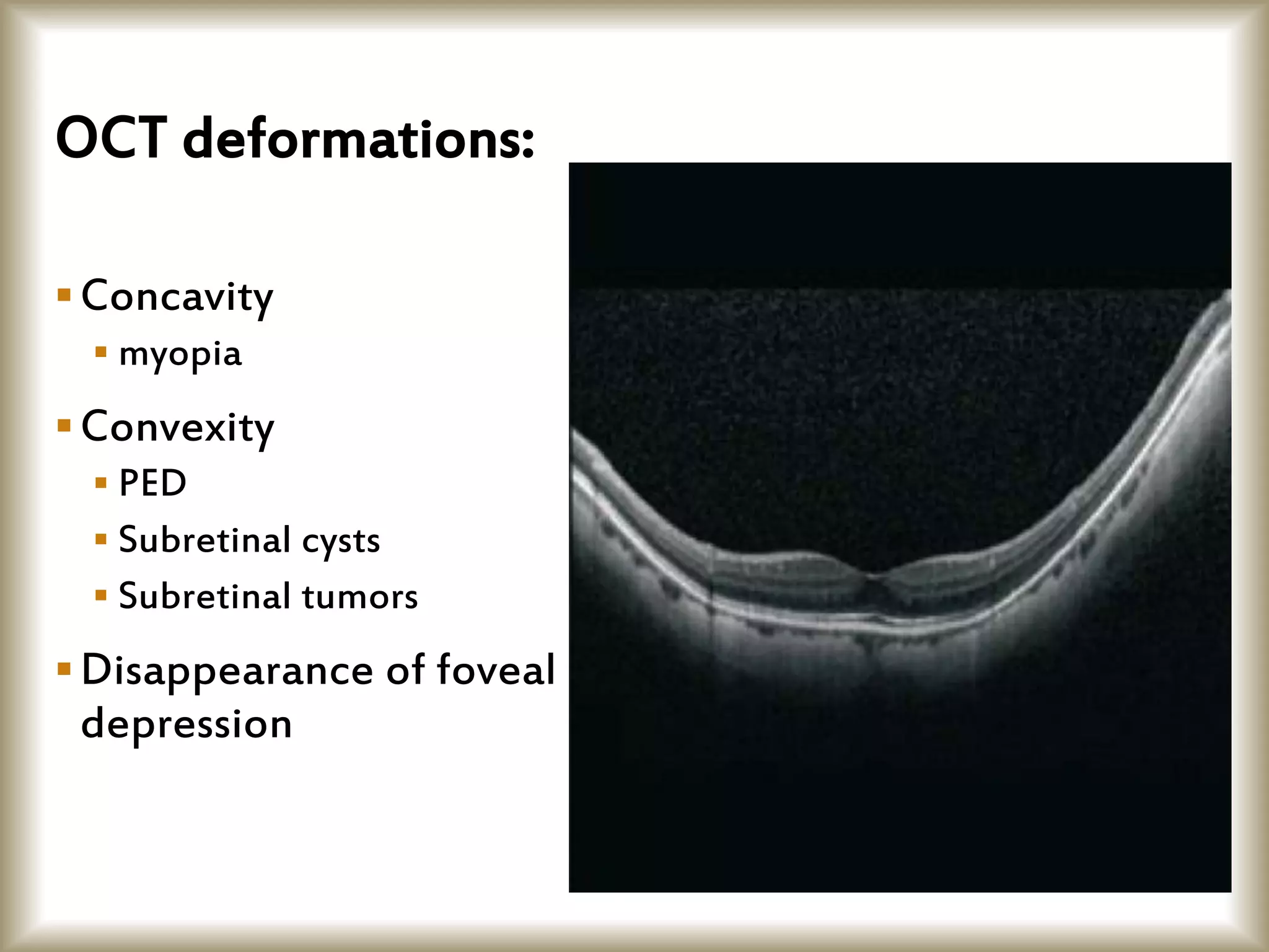 Optical Coherence Tomography | PPTX