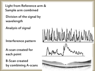 Optical Coherence Tomography | PPTX