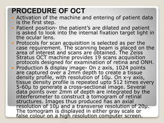 OCT , Laser therapy for DR , Vitrectomy | PPTX | Eye and Vision ...