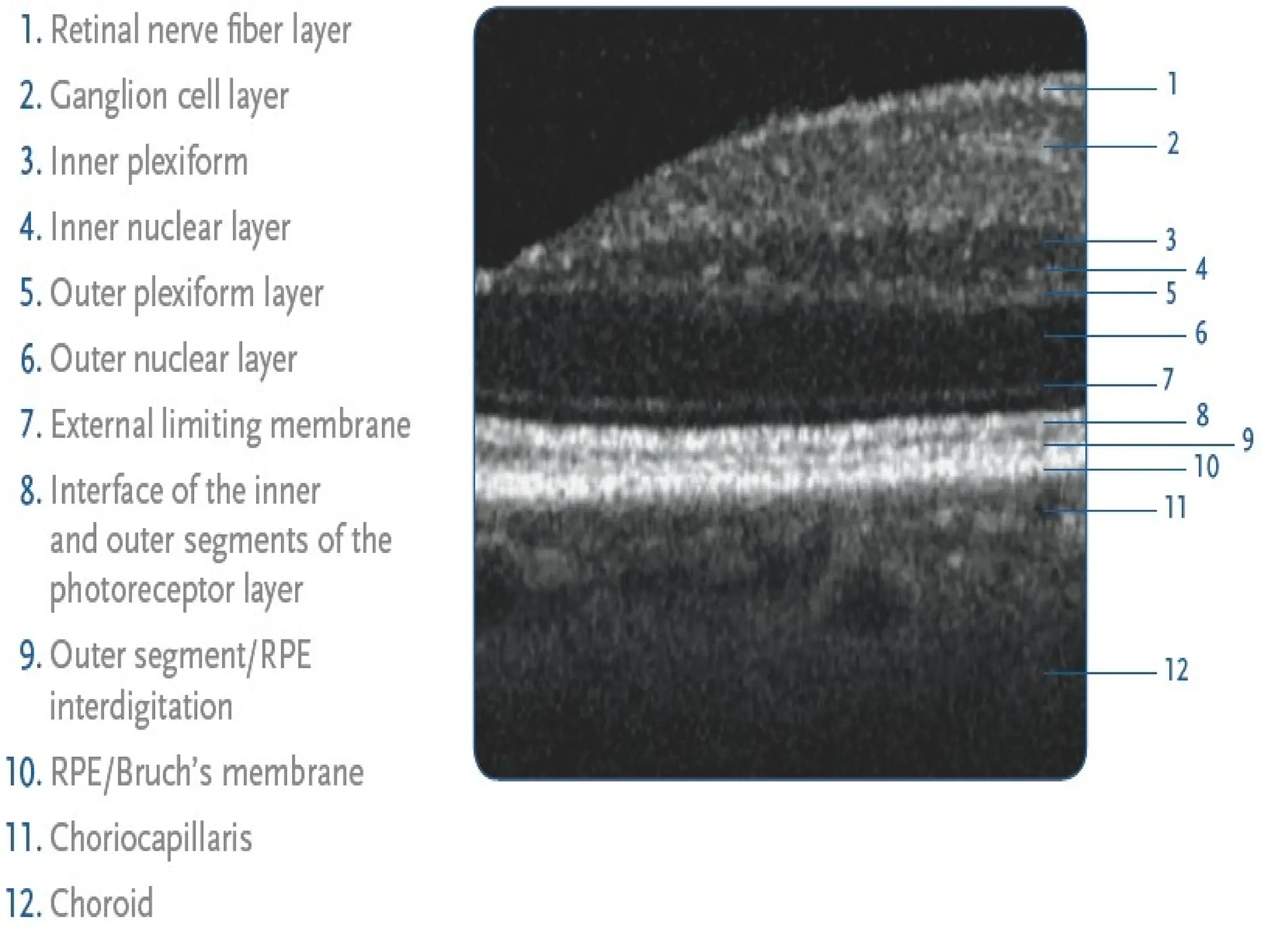 Optical Coherence Tomography - retinal layers.pptx
