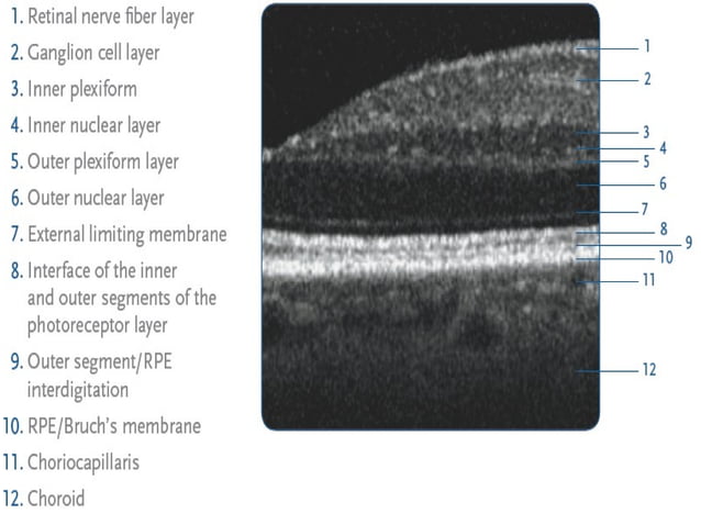 Optical Coherence Tomography - retinal layers.pptx