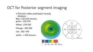 Optical coherence tomography)(OCT) | PPTX