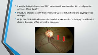 Optical coherence tomography in glaucoma - Dr Shylesh Dabke | PPTX