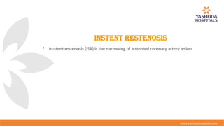 OPTICAL COHERENCE TOMOGRAPHY STUDY IN IN-STENT RESTENOSIS (1).pptx