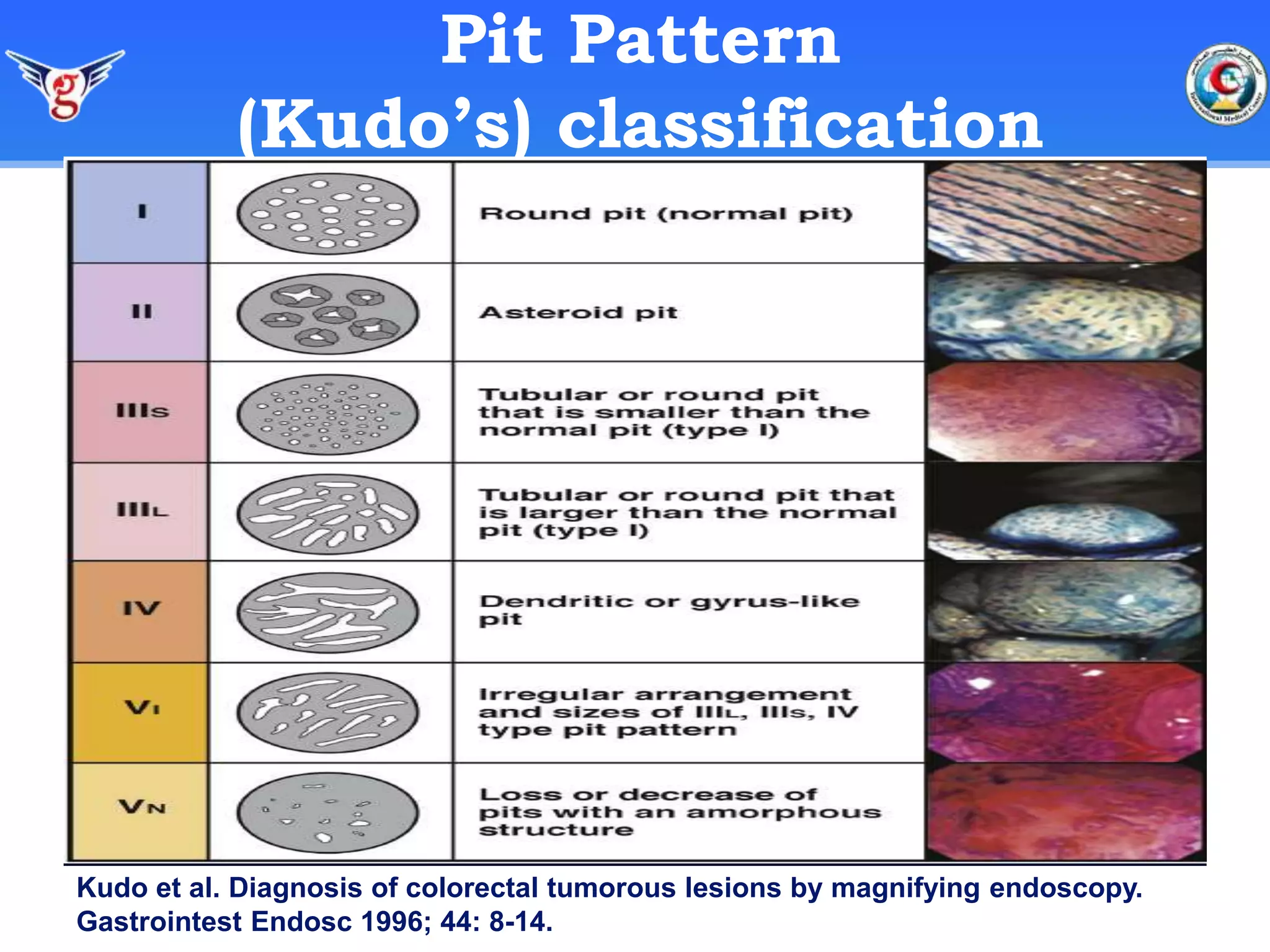 Optical diagnosis of colorectal neoplasia. GastroMilitary 2021. https ...