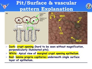 Optical diagnosis of colorectal neoplasia. GastroMilitary 2021. https ...