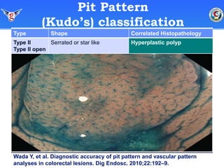 Optical diagnosis of colorectal neoplasia. GastroMilitary 2021. https ...