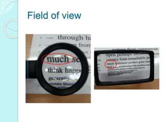 Optical low vision aids | PPTX