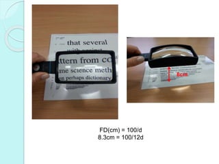 Optical low vision aids | PPTX
