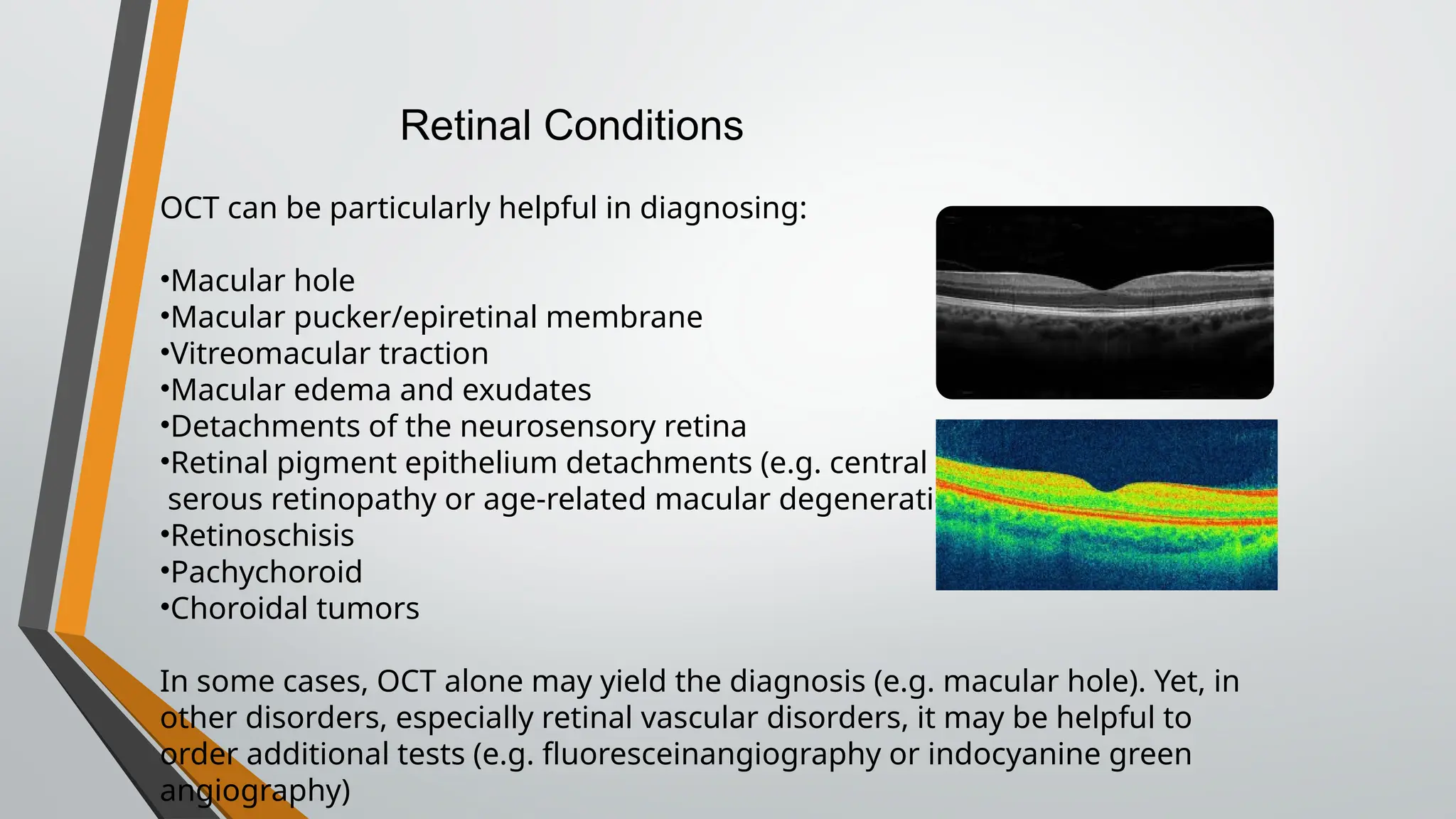 Optical coherence tomography (OCT) retinal examination.pptx