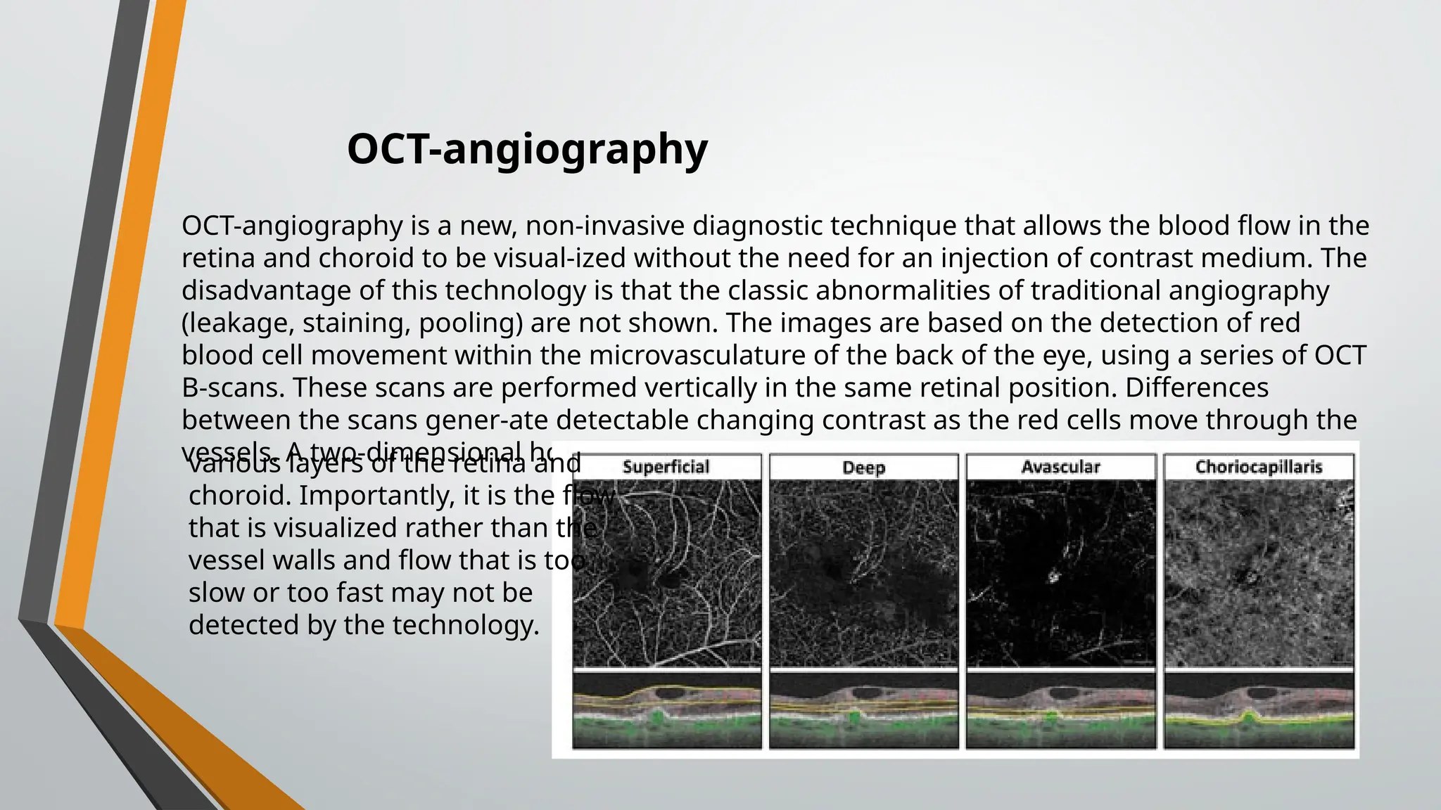 Optical coherence tomography (OCT) retinal examination.pptx