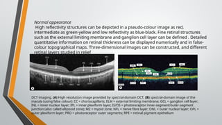 Optical coherence tomography (OCT) retinal examination.pptx