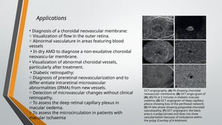 Optical coherence tomography (OCT) retinal examination.pptx
