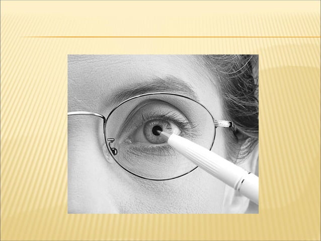 Optical prism decentration | PPT