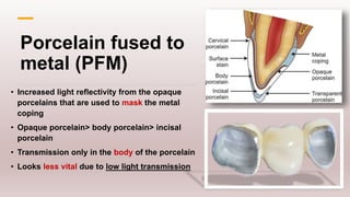Optical props of dental ceramics part 1 | PPT