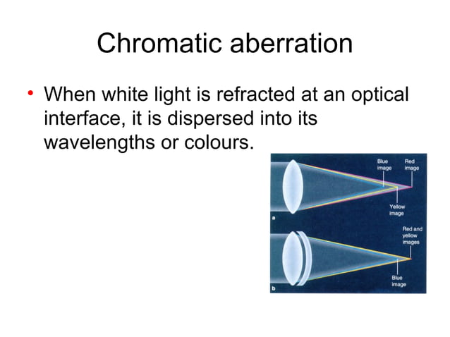 Optical system of eye gauri s | PPT