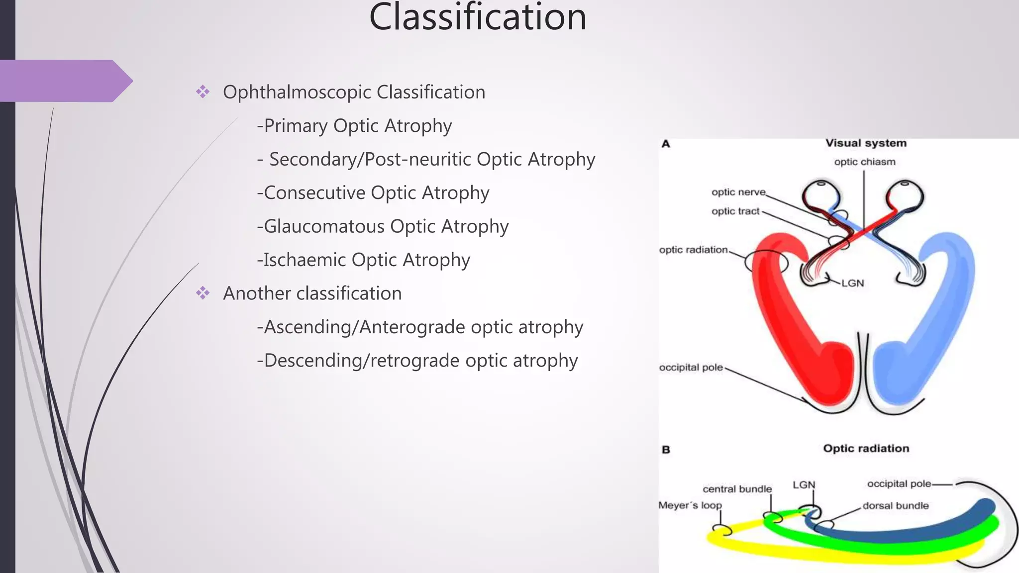 Optic atrophy | PPTX