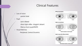 Optic atrophy | PPTX