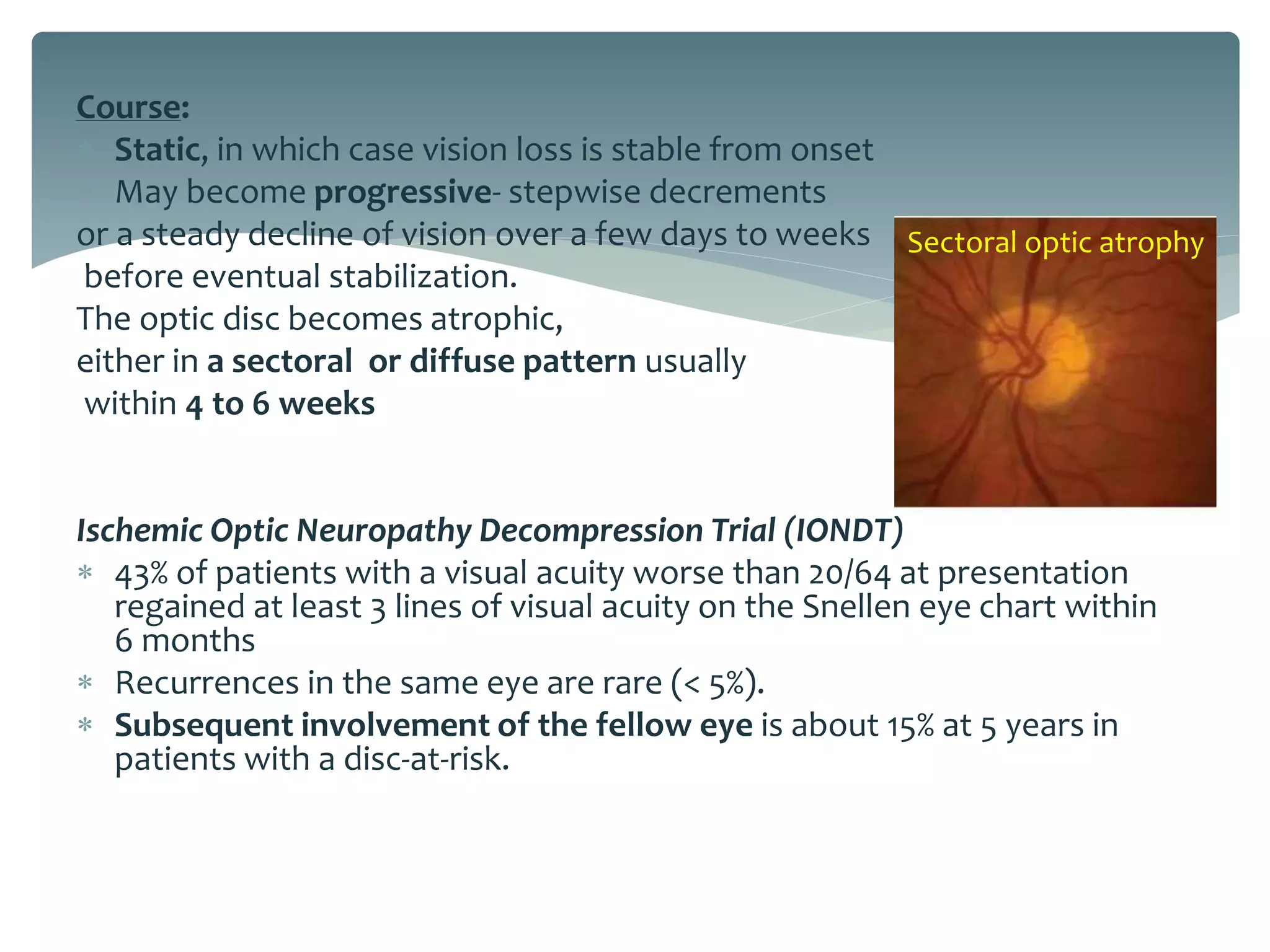 Optic atrophy | PPTX