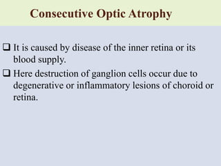 Optic Atrophy | PPTX