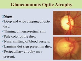 Optic Atrophy | PPTX | Eye and Vision Conditions | Diseases and Conditions