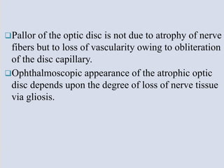 Optic Atrophy | PPTX
