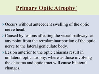 Optic Atrophy | PPTX