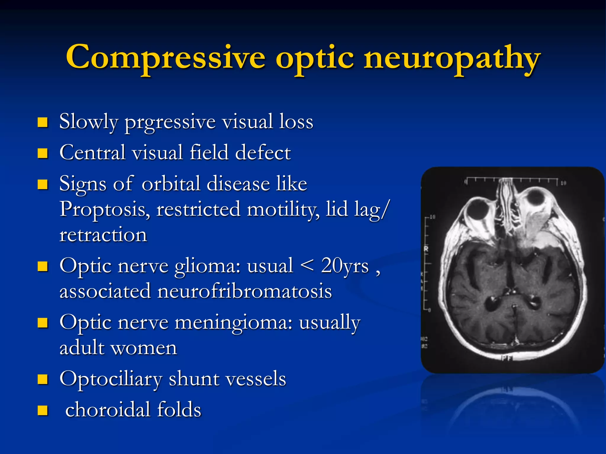 optic atrophy.ppt