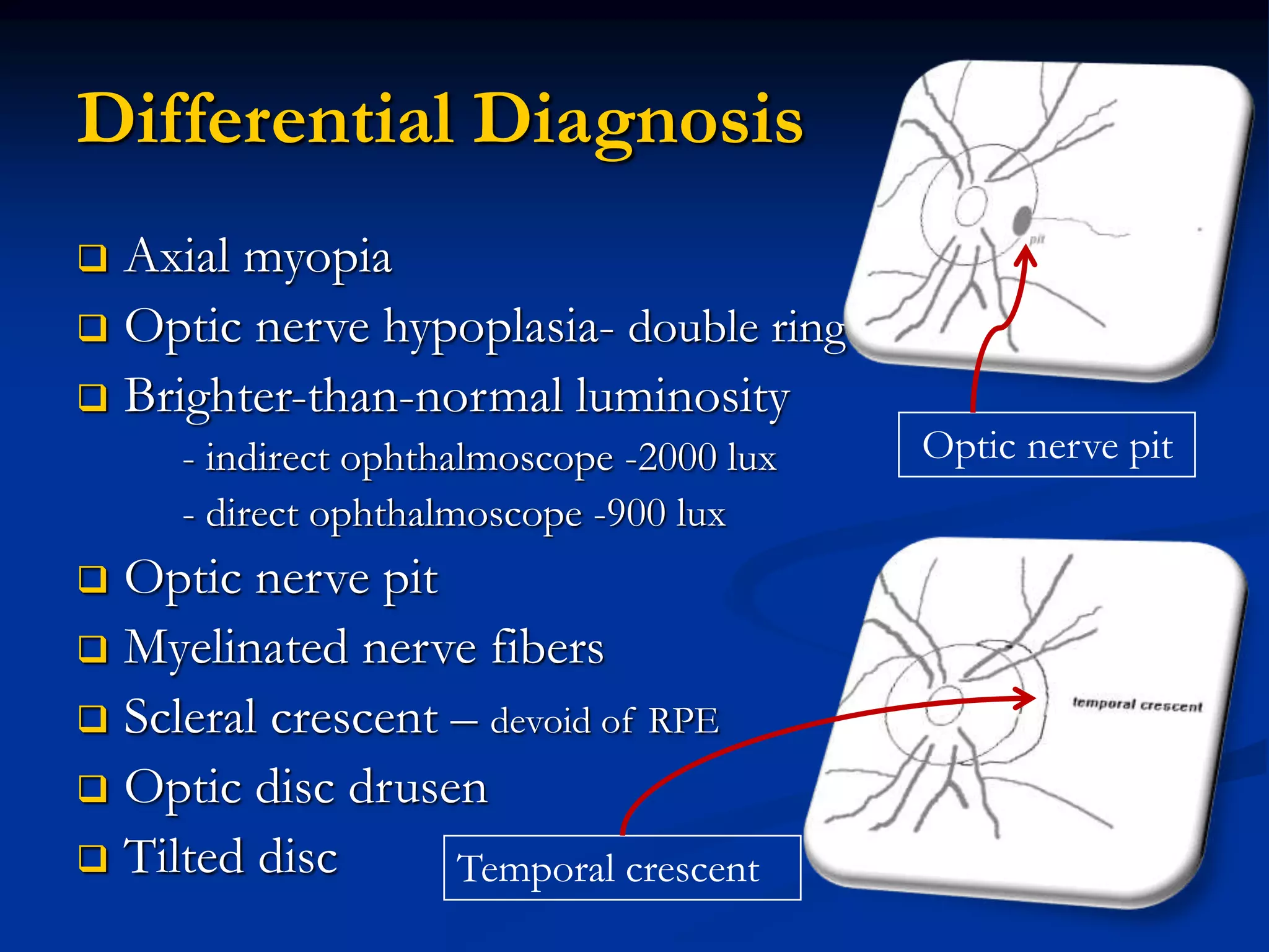 optic atrophy.ppt