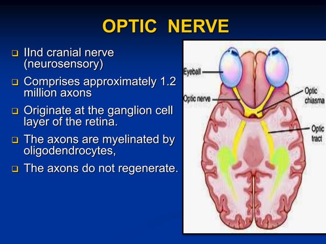 optic atrophy.ppt | Eye and Vision Conditions | Diseases and Conditions