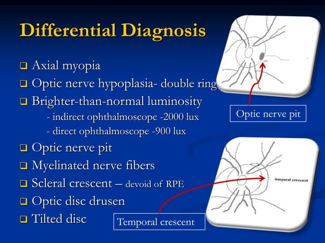 optic atrophy.ppt | Eye and Vision Conditions | Diseases and Conditions