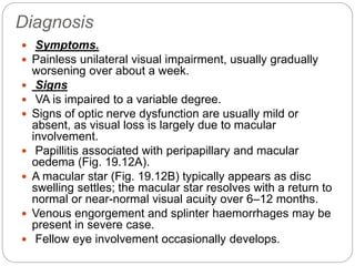 Optic atrophy and neuroretinitis | PPTX