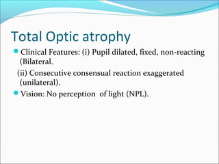 Optic atrophy (b) | PPT