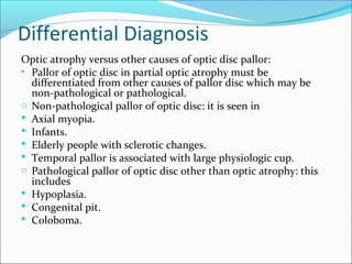 Optic atrophy (b) | PPT