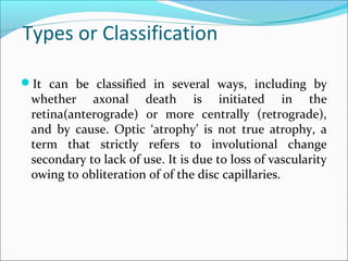 Optic atrophy (b) | PPT