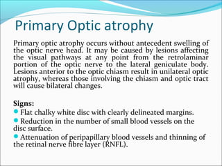 Optic atrophy (b) | PPT