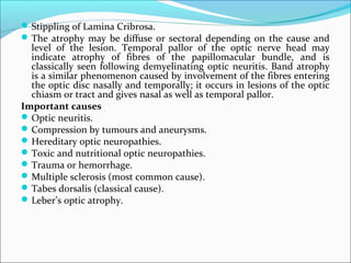 Optic atrophy (b) | PPT