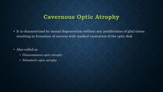 Optic atrophy ppt | PPTX