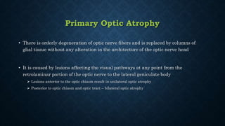 Optic atrophy ppt | PPTX