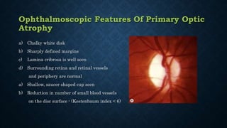 Optic atrophy ppt | PPTX