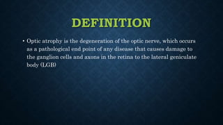 Optic atrophy ppt | PPT | Free Download