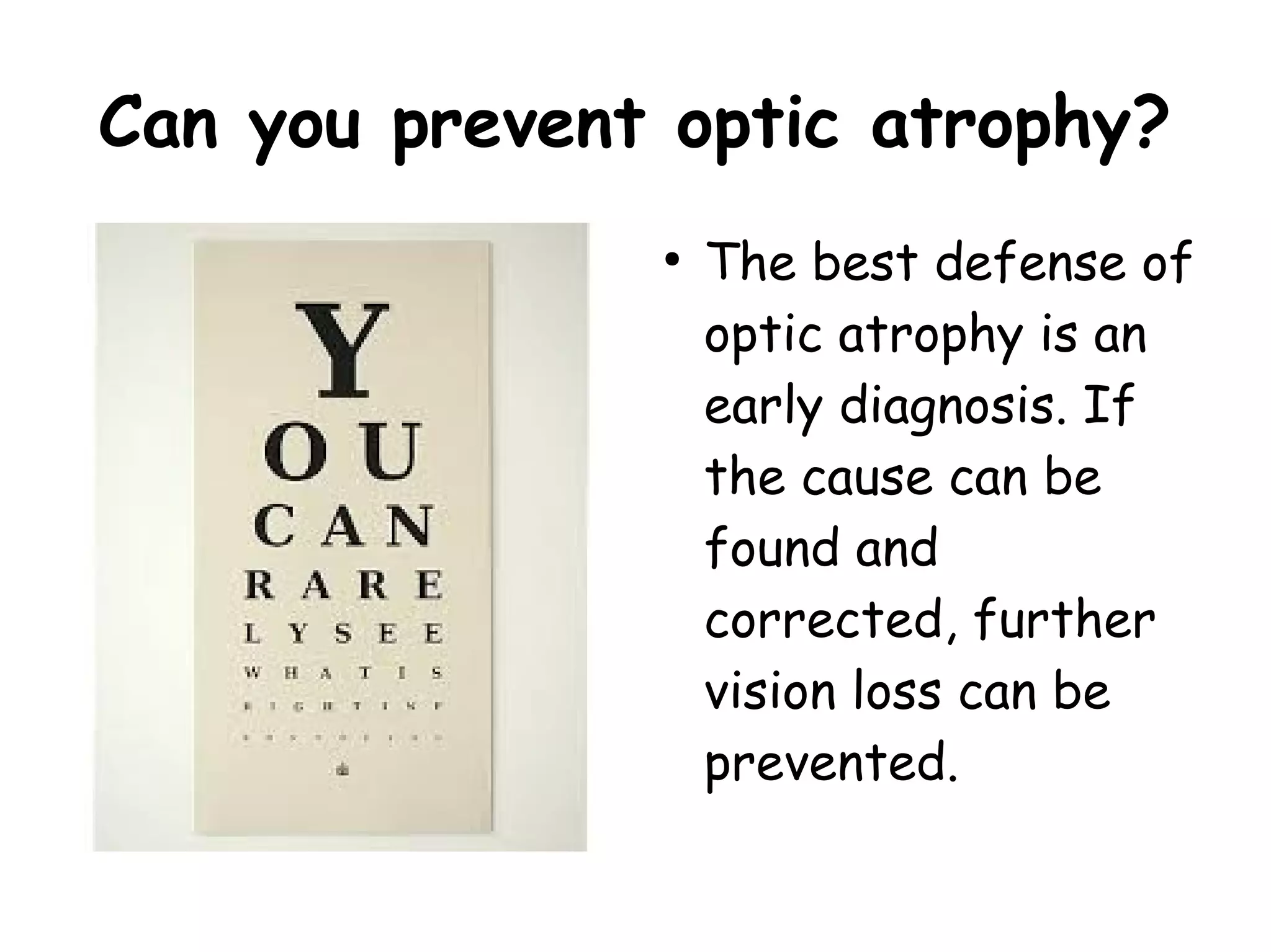 Optic atrophy sa | ODP