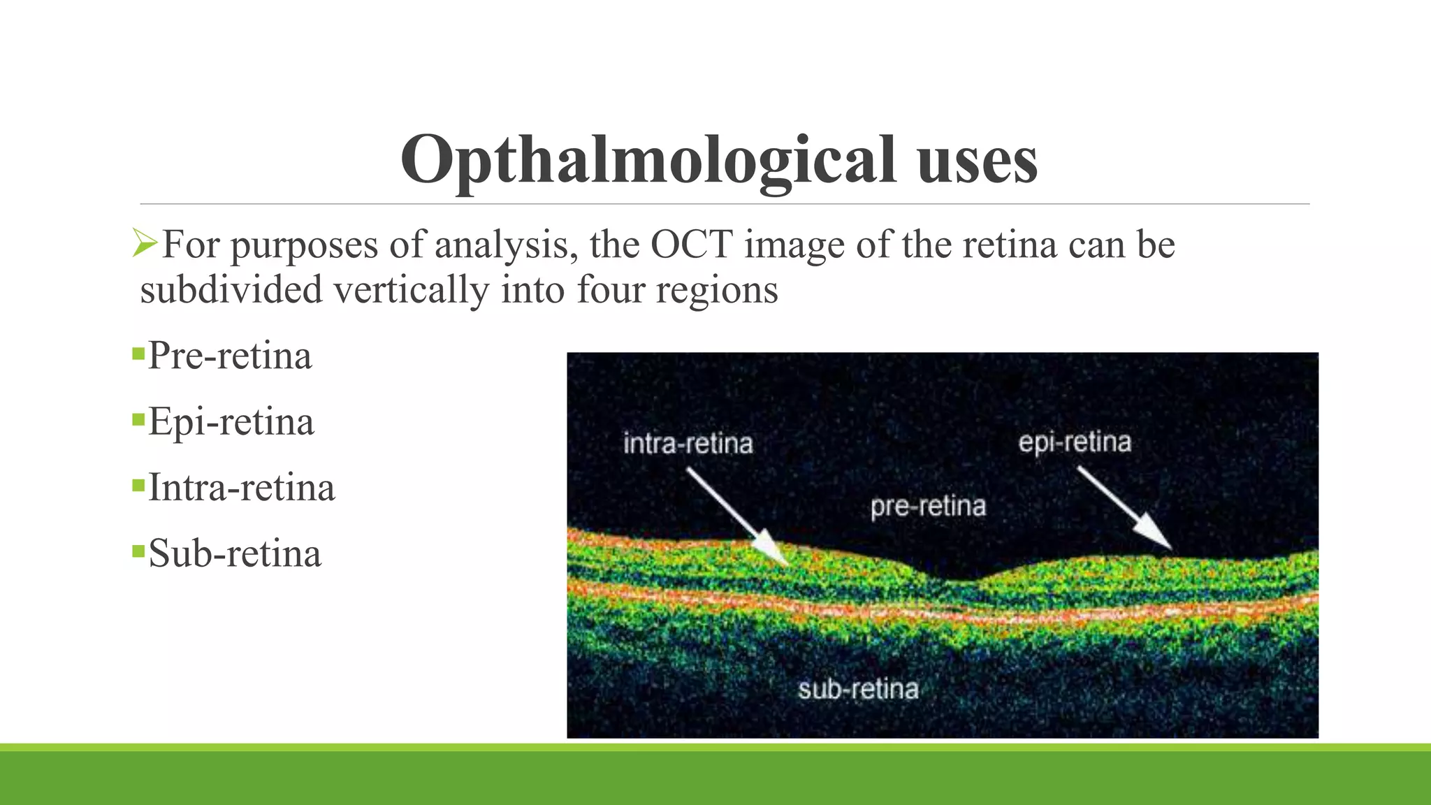 Optic coherence tomography | PPT