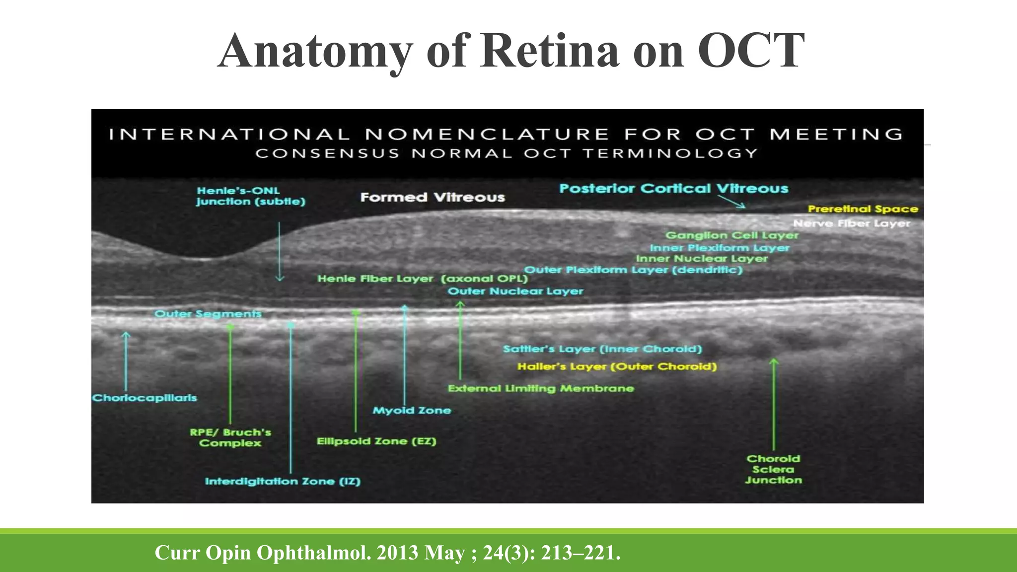 Optic coherence tomography | PPT