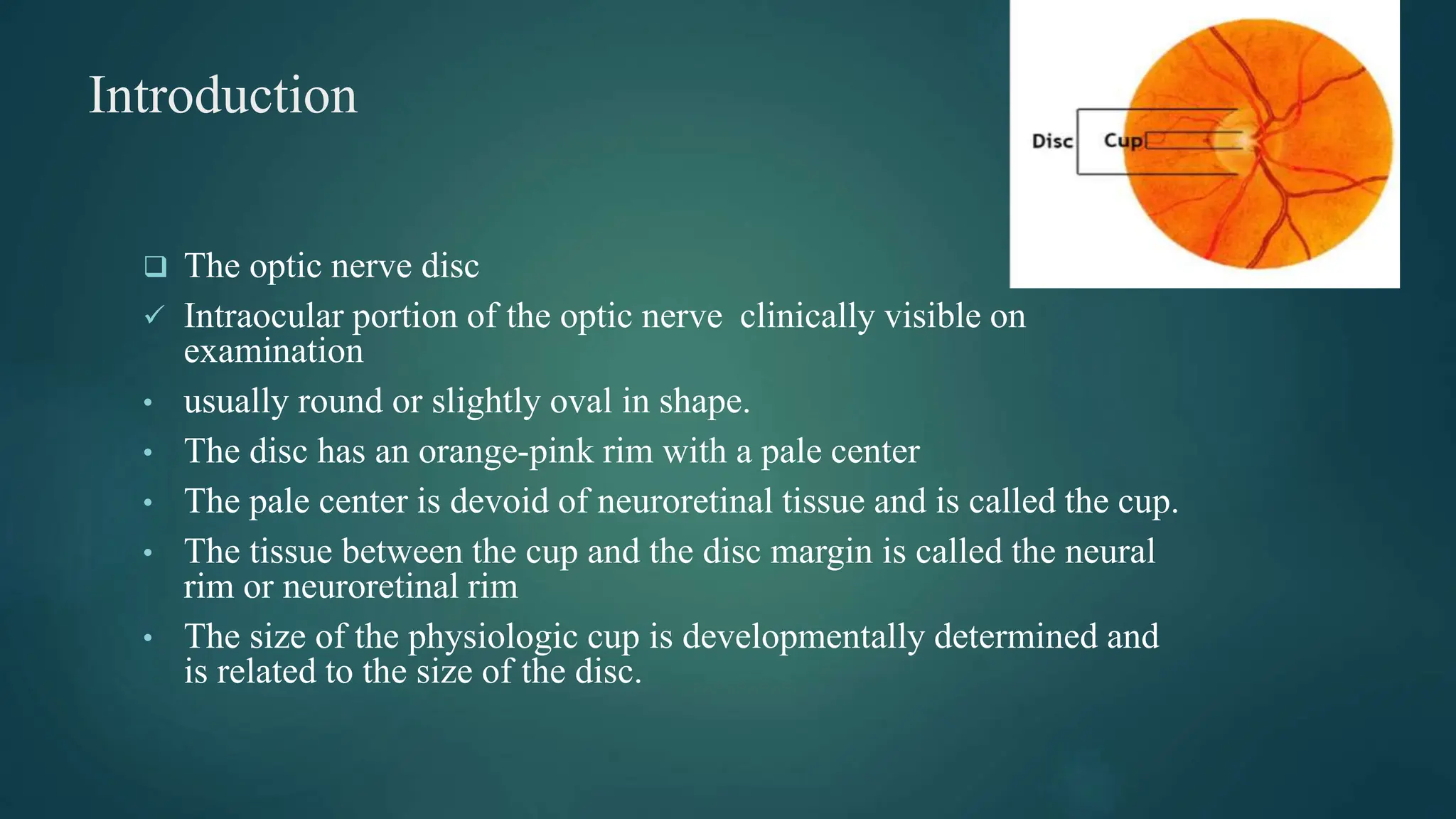 Optic Disc Abnormalities and their presentations | PPTX