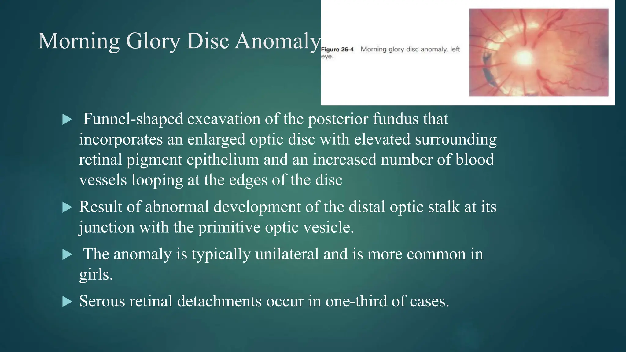 Optic Disc Abnormalities and their presentations | PPTX | Pregnancy ...