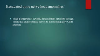 Optic Disc Abnormalities and their presentations | PPTX